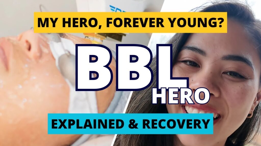BBL Hero In-Office Treatment, Overview, Realistic Recovery and Results ...
